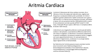 Aritmie | PPTX