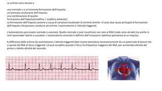 Aritmie | PPTX