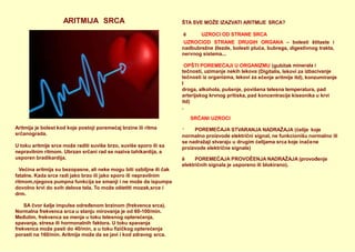 Aritmije | PPT