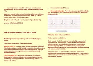 Aritmije | PPTX