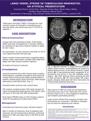 Large Vessel Stroke in Tuberculous Meningitis | PDF
