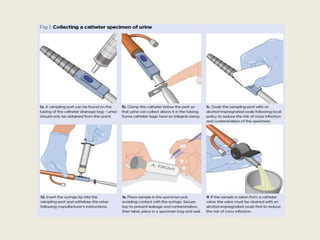 Collection and transport of urine specimen.pptx