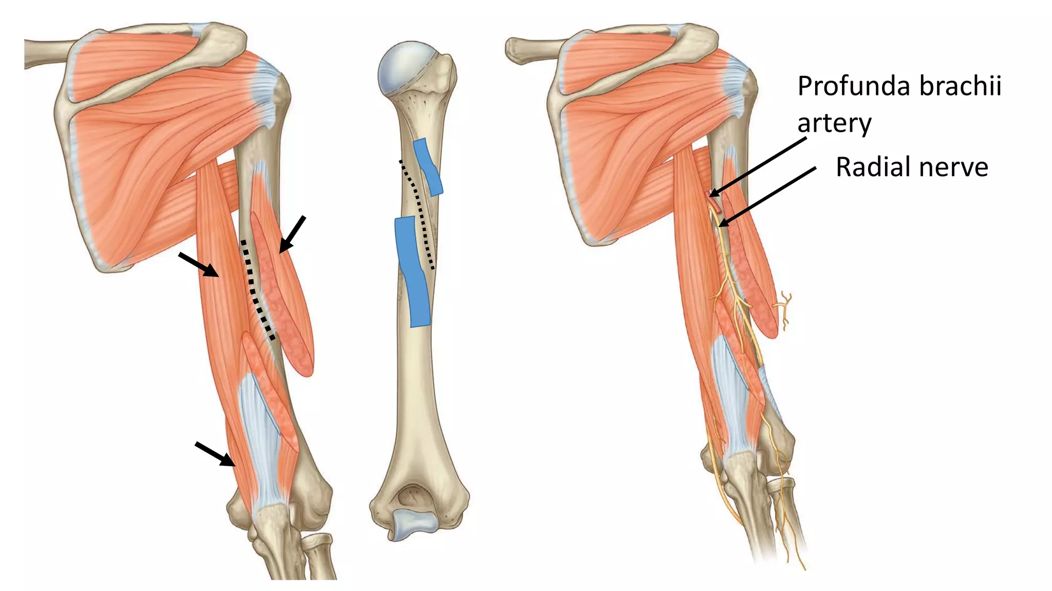 Arm and cubital fossa | PDF