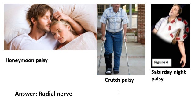 Arm and cubital fossa