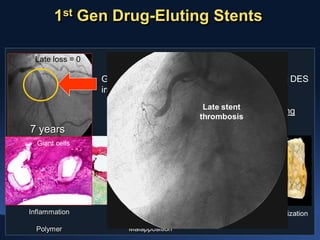 Bare Metal Stents | PPT