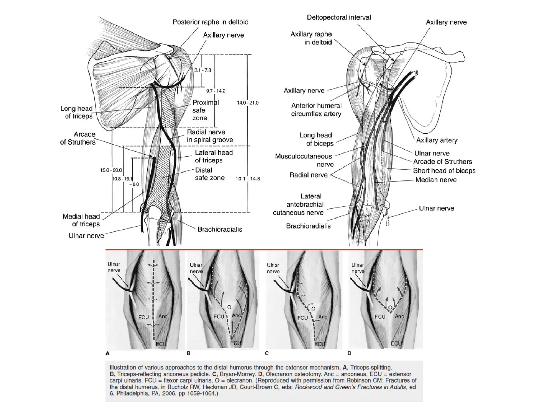 Arm approaches for the management of fracture | PDF