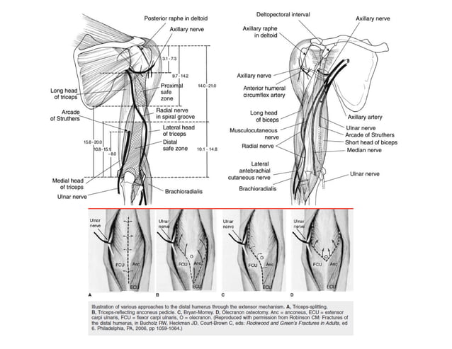 Arm approaches for the management of fracture | PPT