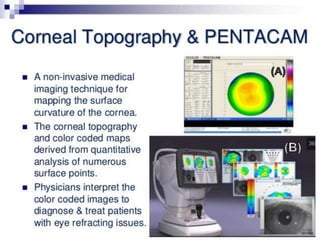 pentacam | PPTX