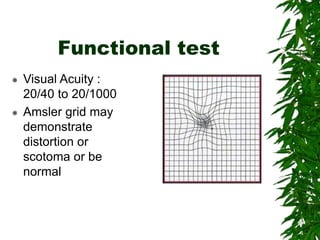 Low Vision Managment, Age Related Macular Degeneration ARMD | PPT