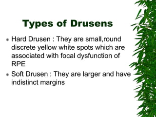 Low Vision Managment, Age Related Macular Degeneration ARMD | PPT