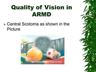Low Vision Managment, Age Related Macular Degeneration ARMD | PPT