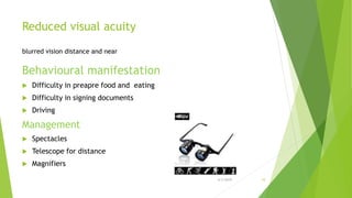 Armd cases in low vision | PPTX