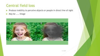Armd cases in low vision | PPTX