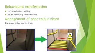 Armd cases in low vision | PPTX