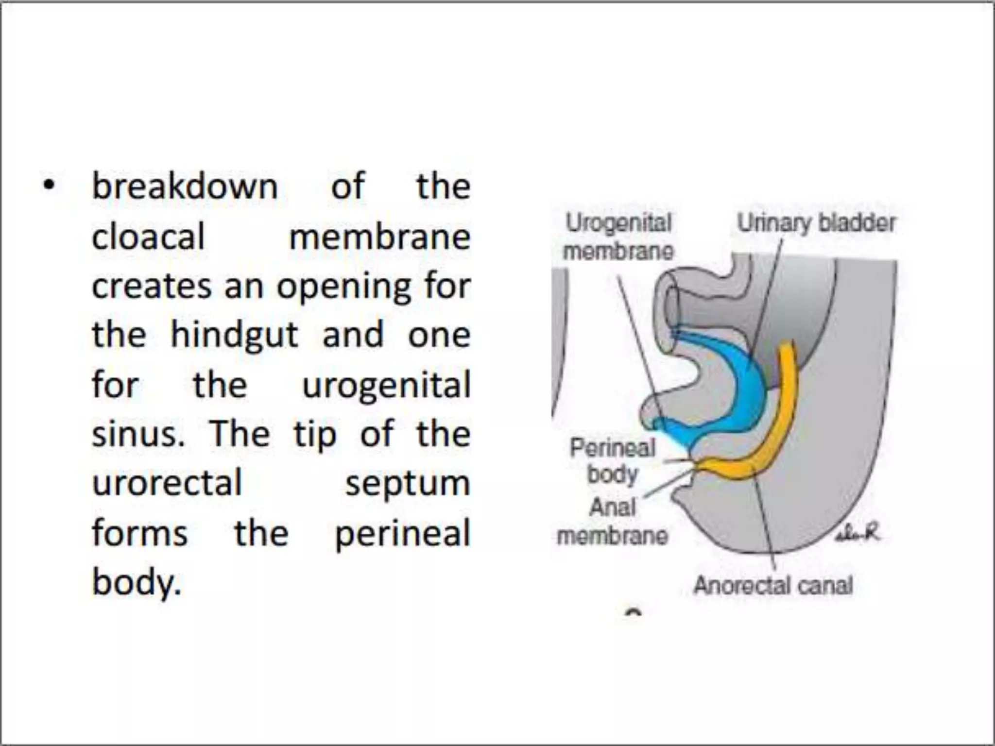Anorectal malformation | PPTX
