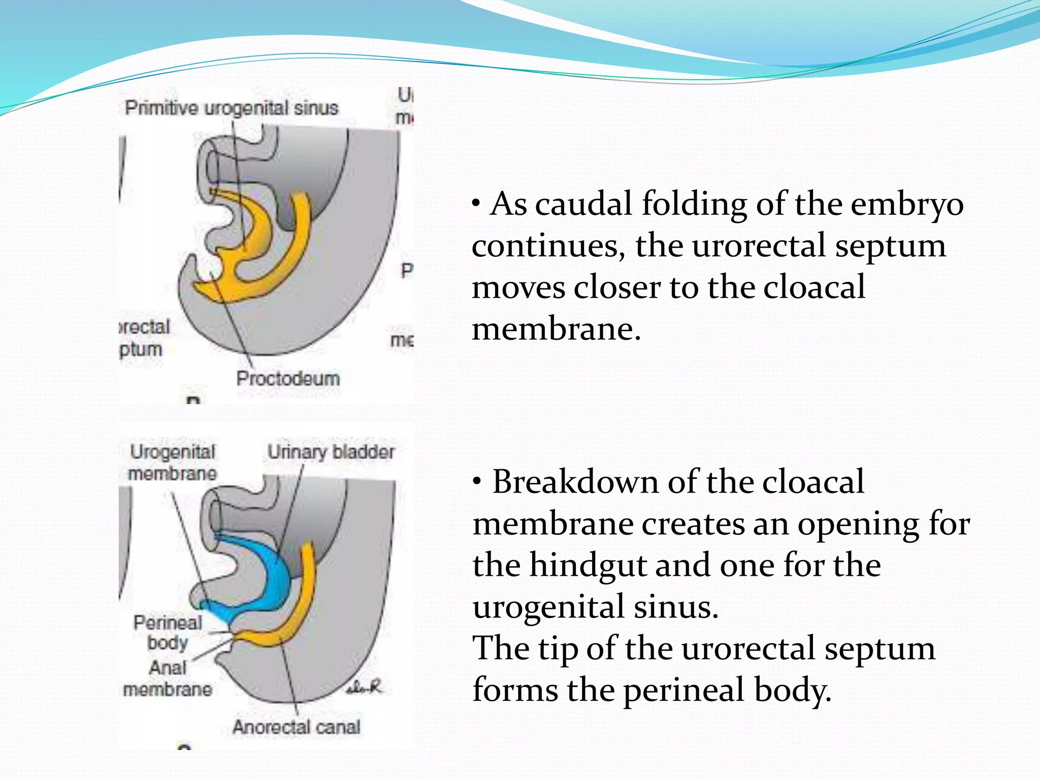 Anorectal Malformations | PPTX