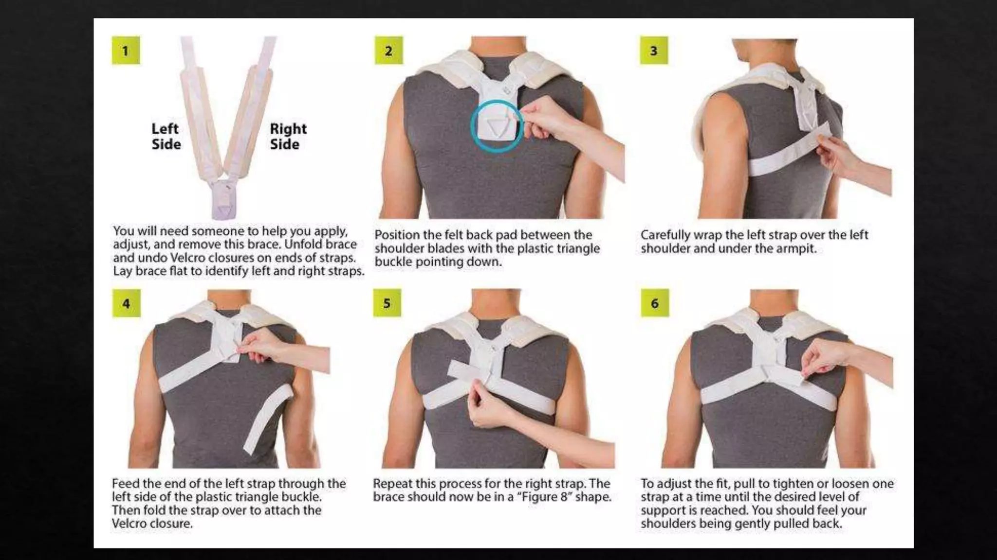 Arm slings & its types | PPTX