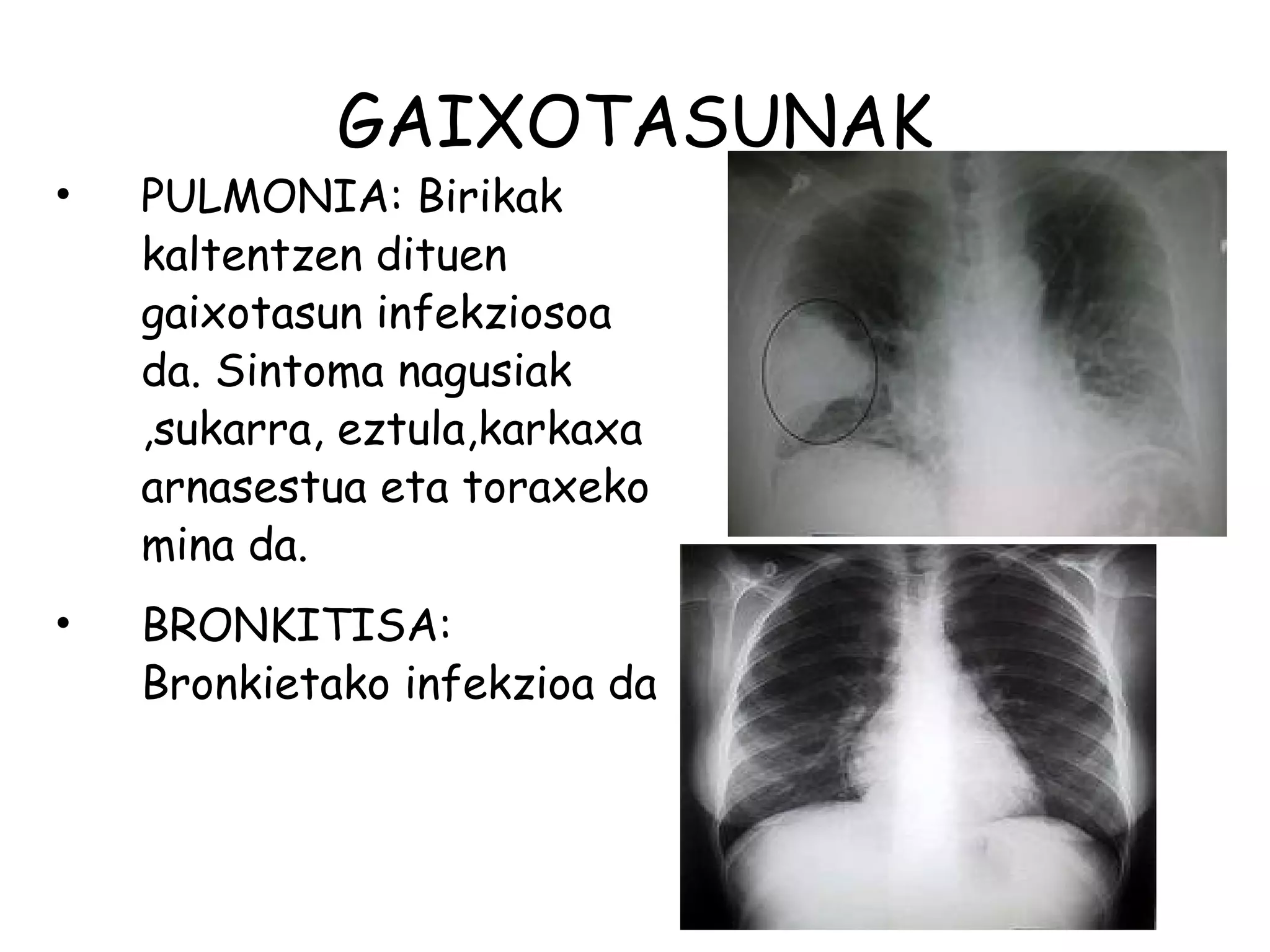 Arnas aparatua | PPT