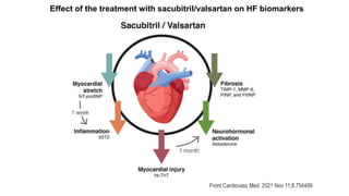 ARNI- Right choice in HF (3).pptx