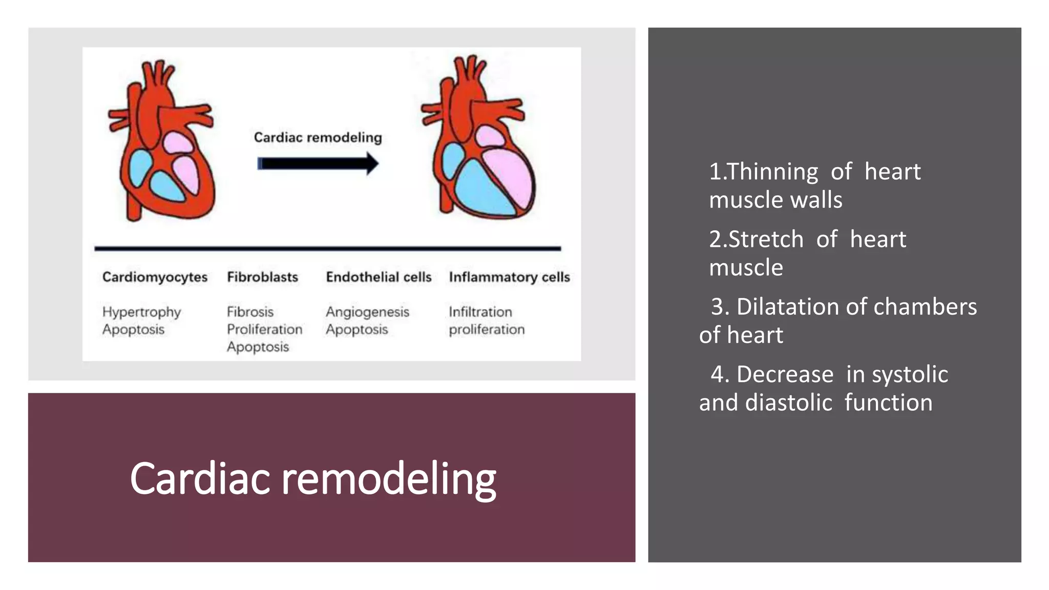 ARNI as new standard of care in Heart Failure | PPTX