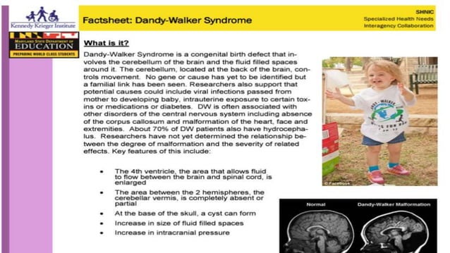 Arnold Chiari Malformation And Dandy Walker Syndrome.pptx