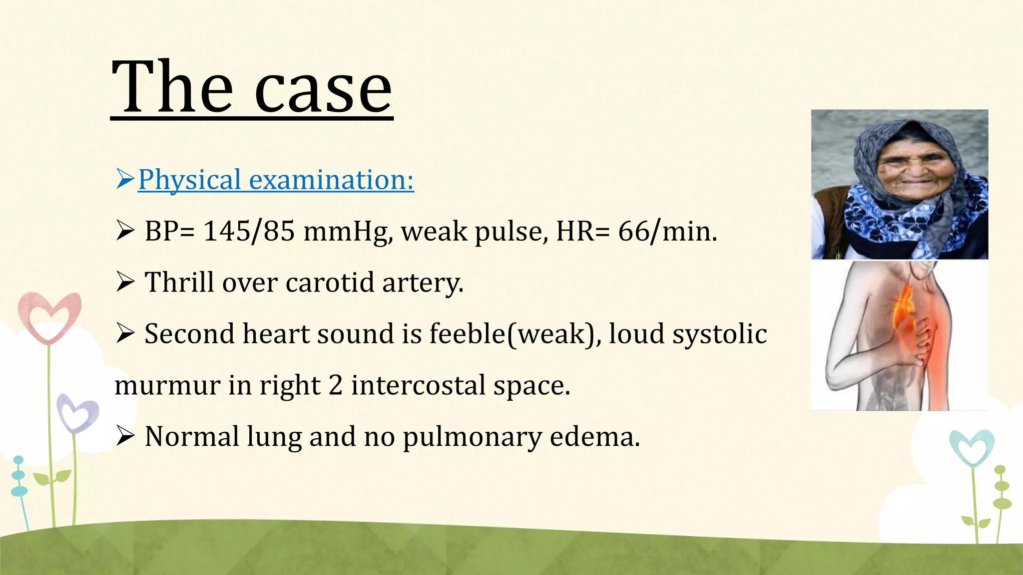 Aortic stenosis | PPTX