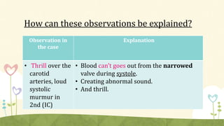 Aortic stenosis | PPTX