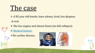 Aortic stenosis | PPTX
