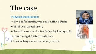 Aortic stenosis | PPTX