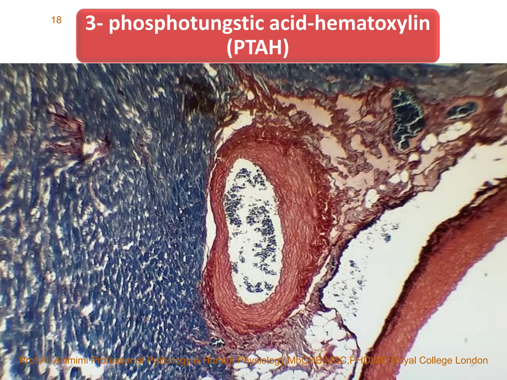 A Routine and Special Staining in Histopathology LAB practice lec ...