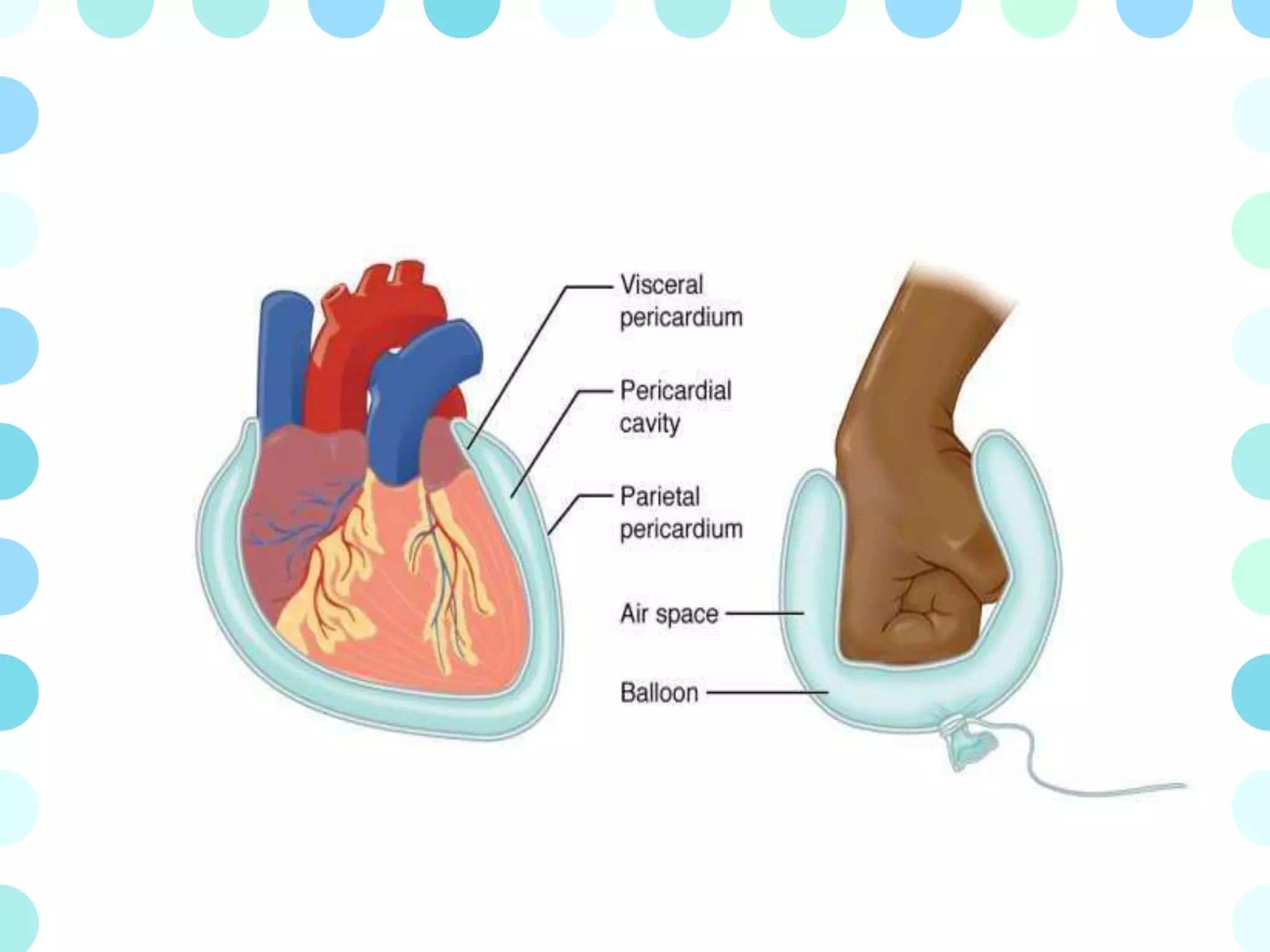 Pericardial diseases | PPTX