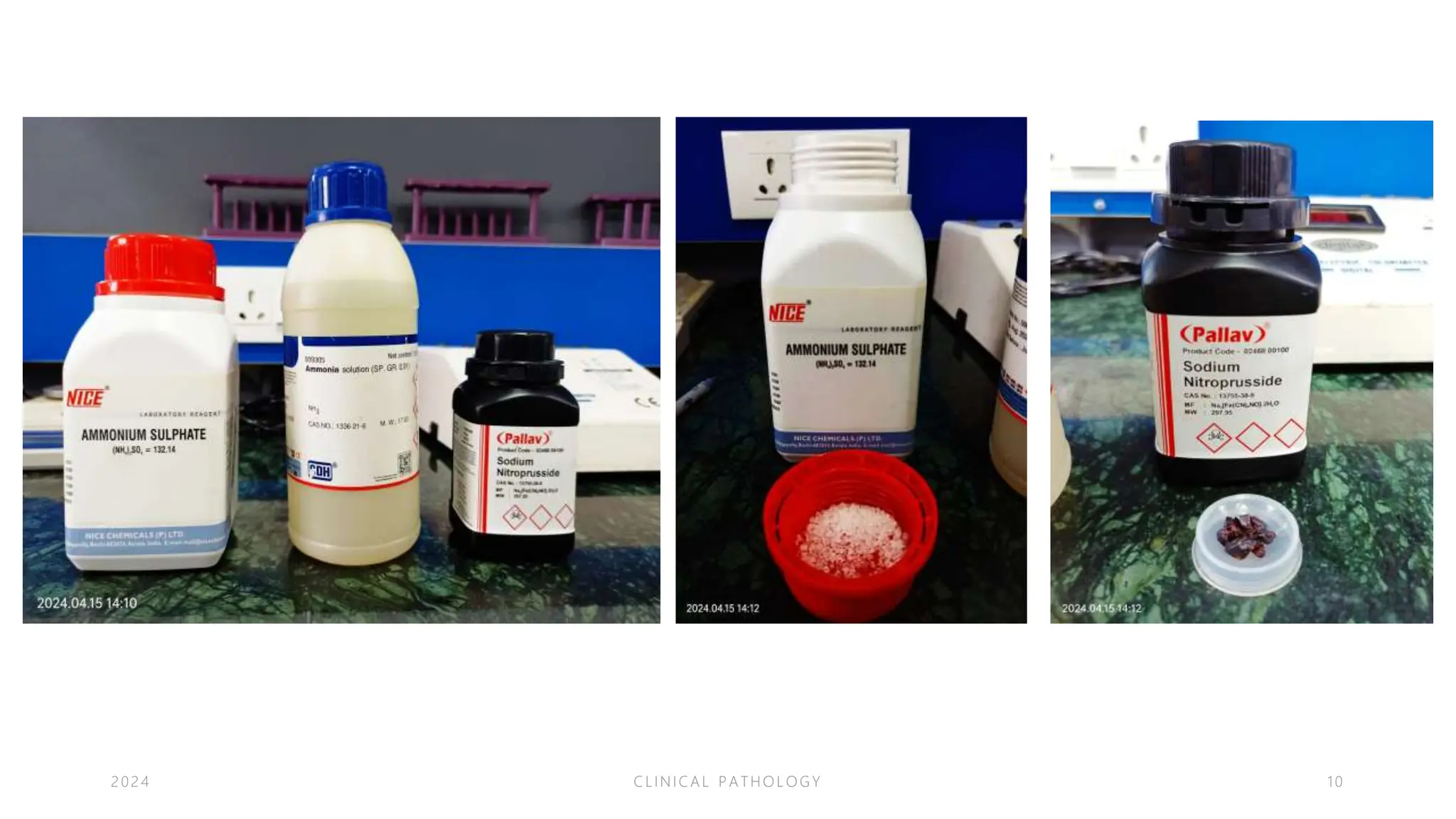 Ketone body examination in urine by Rother's Test | PPTX