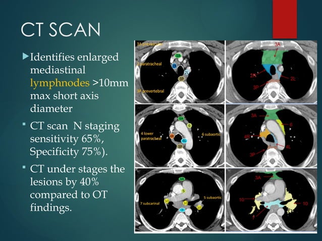 Mediastinal anatomy and staging (Invasive & Non Invasive) | PPTX