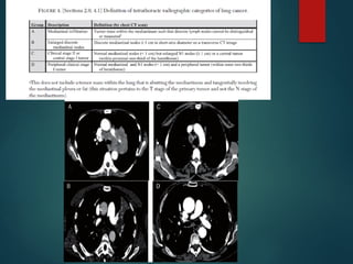 Mediastinal anatomy and staging (Invasive & Non Invasive) | PPTX