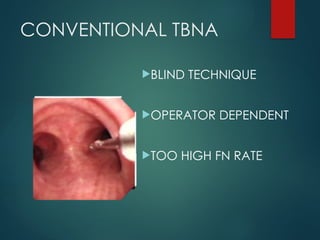 Mediastinal anatomy and staging (Invasive & Non Invasive) | PPTX