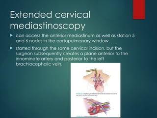 Mediastinal anatomy and staging (Invasive & Non Invasive) | PPTX