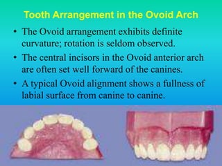 Arrangement of anterior artificial teeth | PPTX