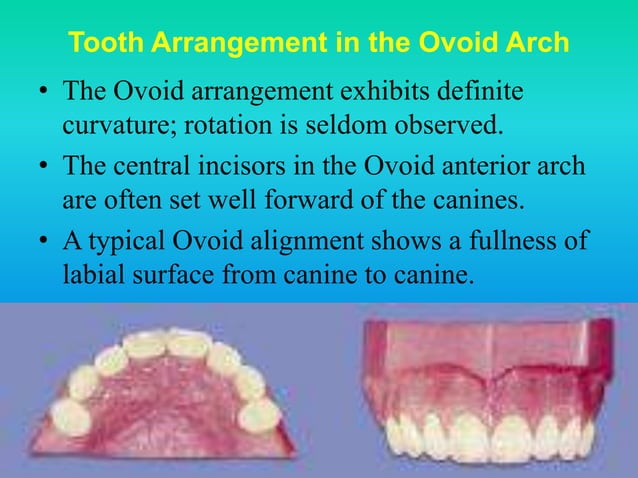 Arrangement of anterior artificial teeth | PPTX | Dental Health ...