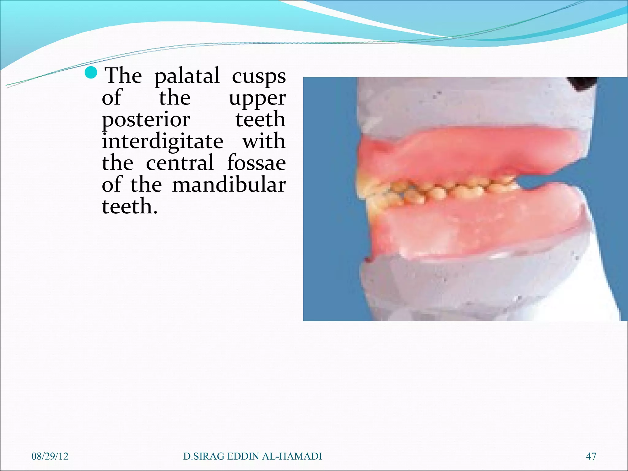 Arrangement of artificial teeth 1 | PPT