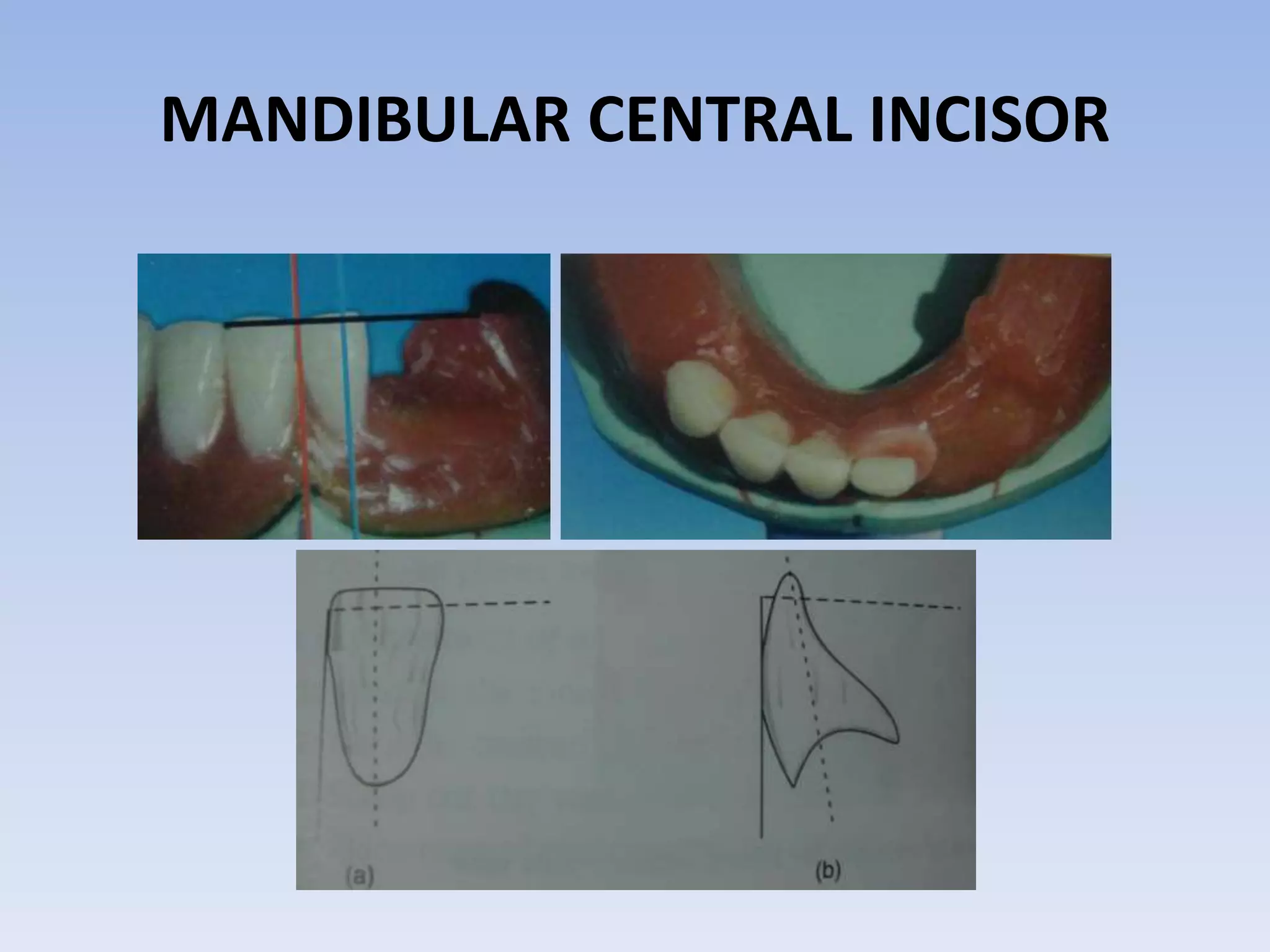 Arrangement of artificial teeth | PPTX