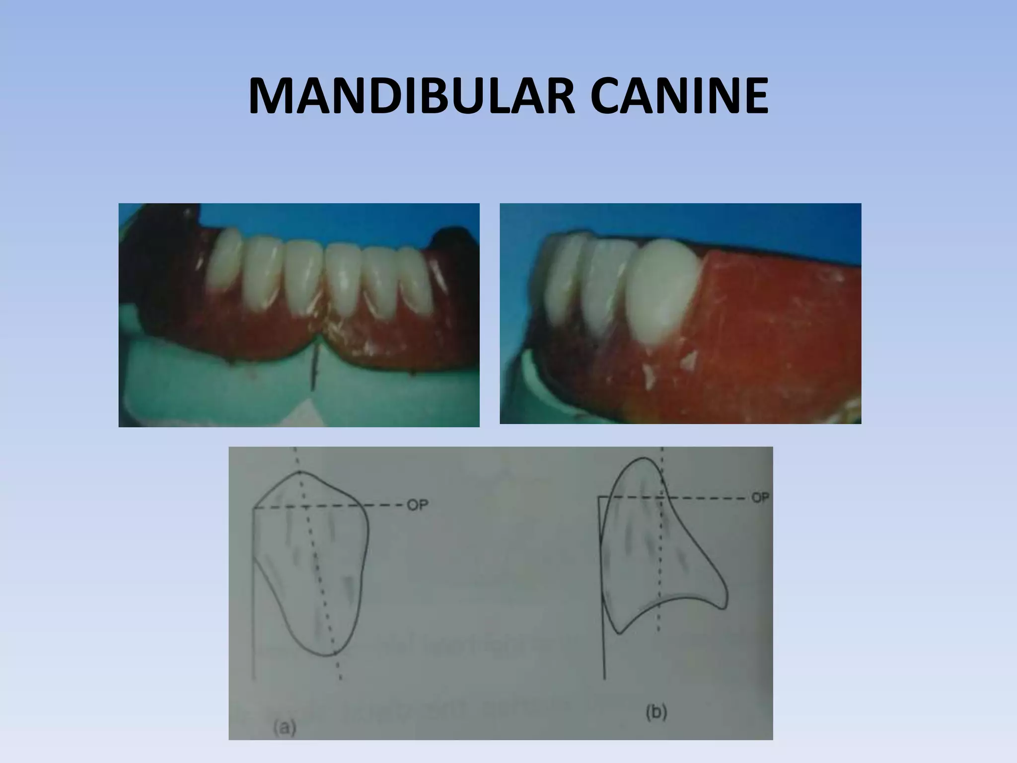 Arrangement of artificial teeth | PPTX
