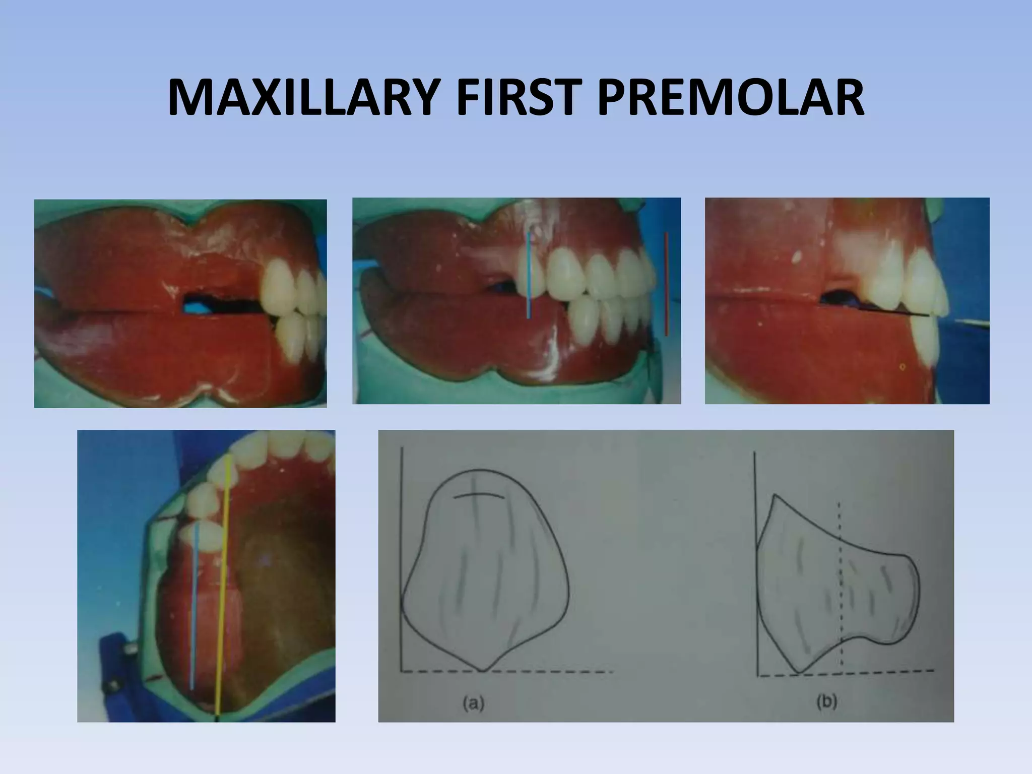 Arrangement of artificial teeth | PPTX