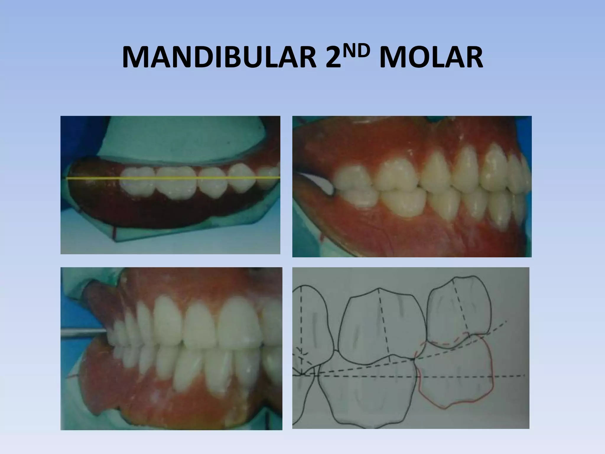 Arrangement of artificial teeth | PPTX