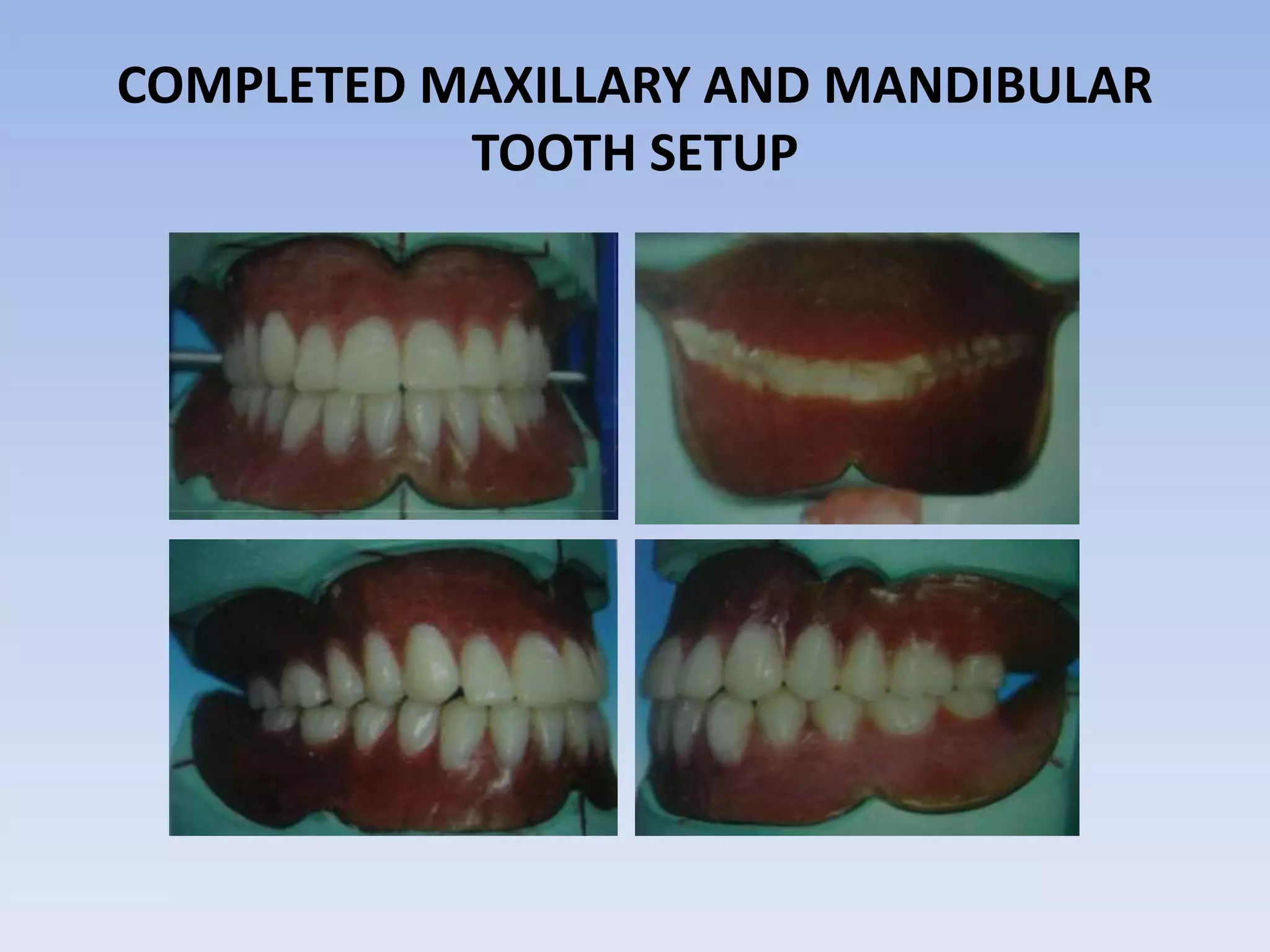 Arrangement of artificial teeth | PPTX