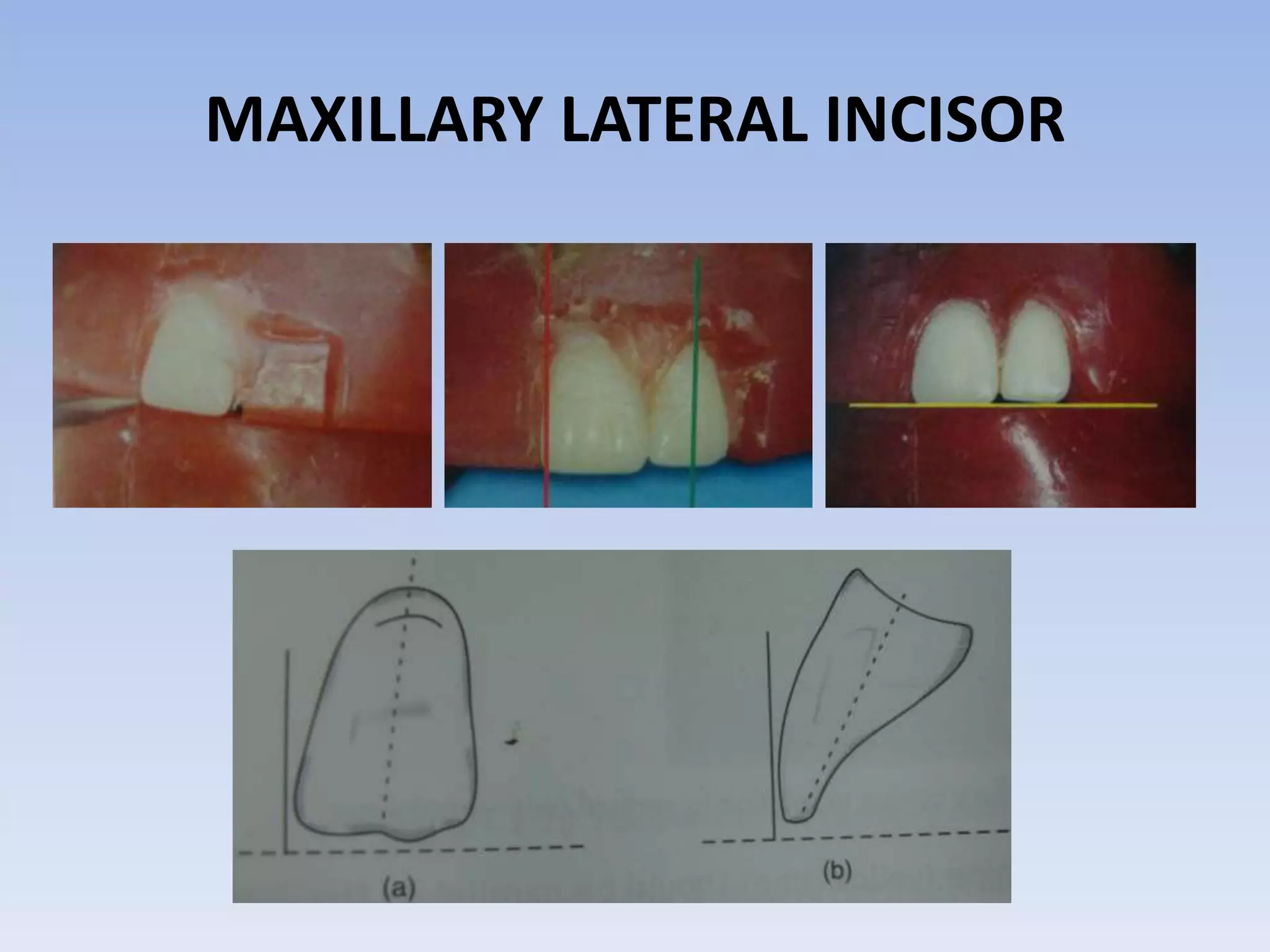 Arrangement of artificial teeth | PPTX