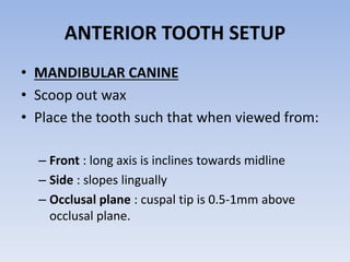 Arrangement of artificial teeth | PPTX