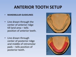 Arrangement of artificial teeth | PPTX