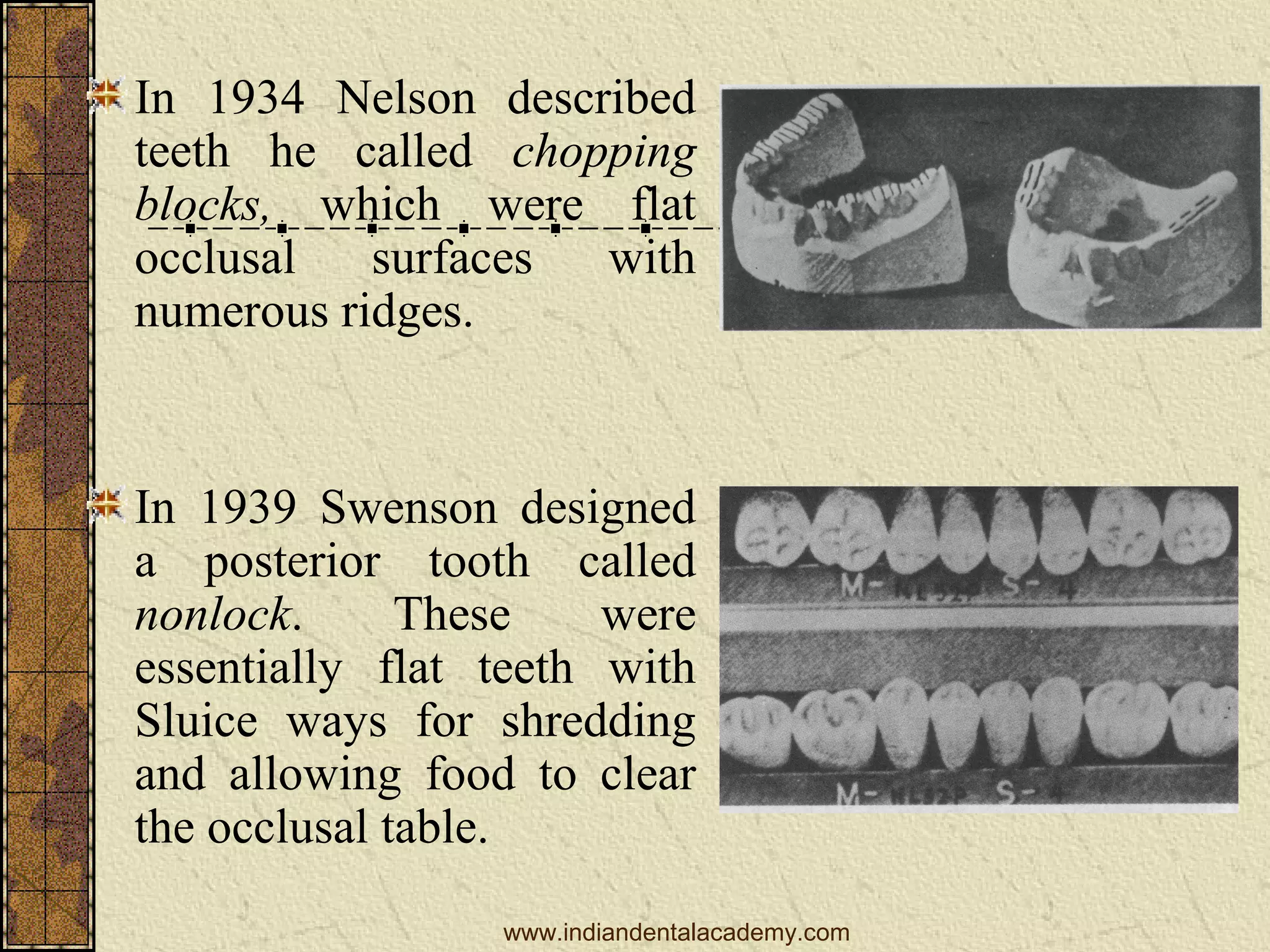 ARRANGEMENT OF POSTERIOR TEETH ACCORDING TO DIFFERENT THEORIES OF ...