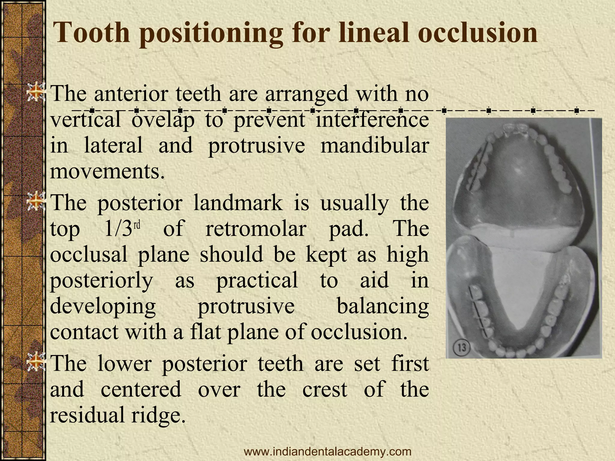 ARRANGEMENT OF POSTERIOR TEETH ACCORDING TO DIFFERENT THEORIES OF ...