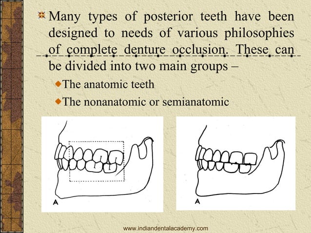 ARRANGEMENT OF POSTERIOR TEETH ACCORDING TO DIFFERENT THEORIES OF ...